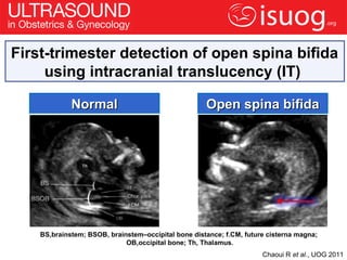 UOG Journal Club: Intra- and interoperator reliability of manual and ...