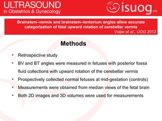 UOG Journal Club: Prenatal diagnosis and outcome of fetal posterior ...