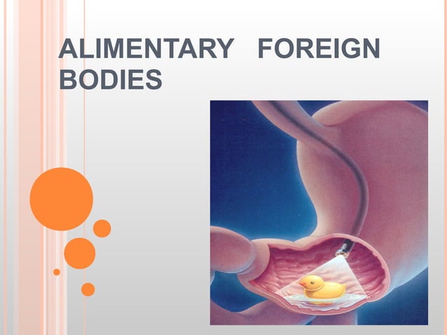 Foreign Body In Children | PPT | Ear, Nose and Throat Conditions ...