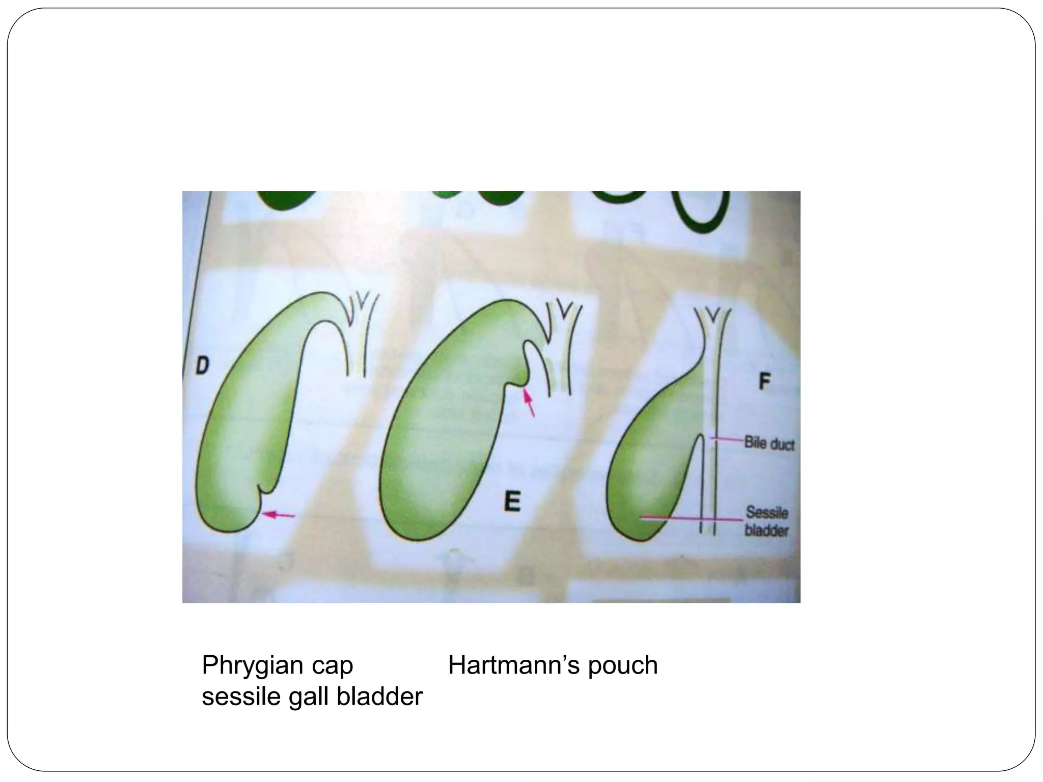 Development of Liver and Gall bladder | PPTX