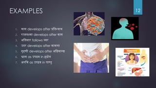 upadrava (Rog Nidan)[1]-1.pptx must to know topic | PPTX