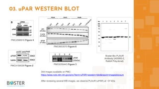 Learn uPAR in 3 minutes | Urokinase plasminogen activator surface ...