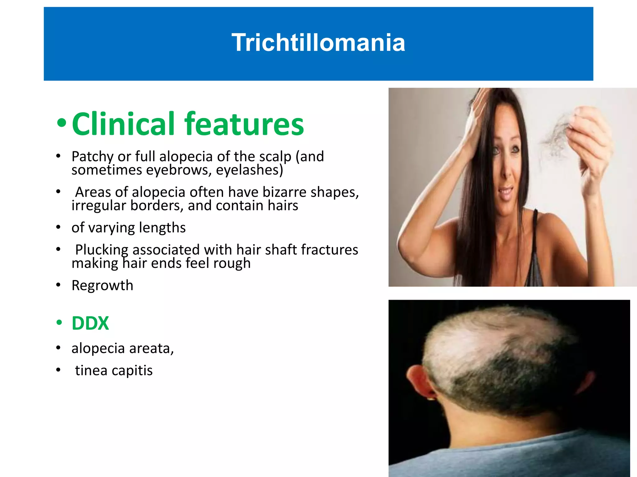 hair diseases | PPTX
