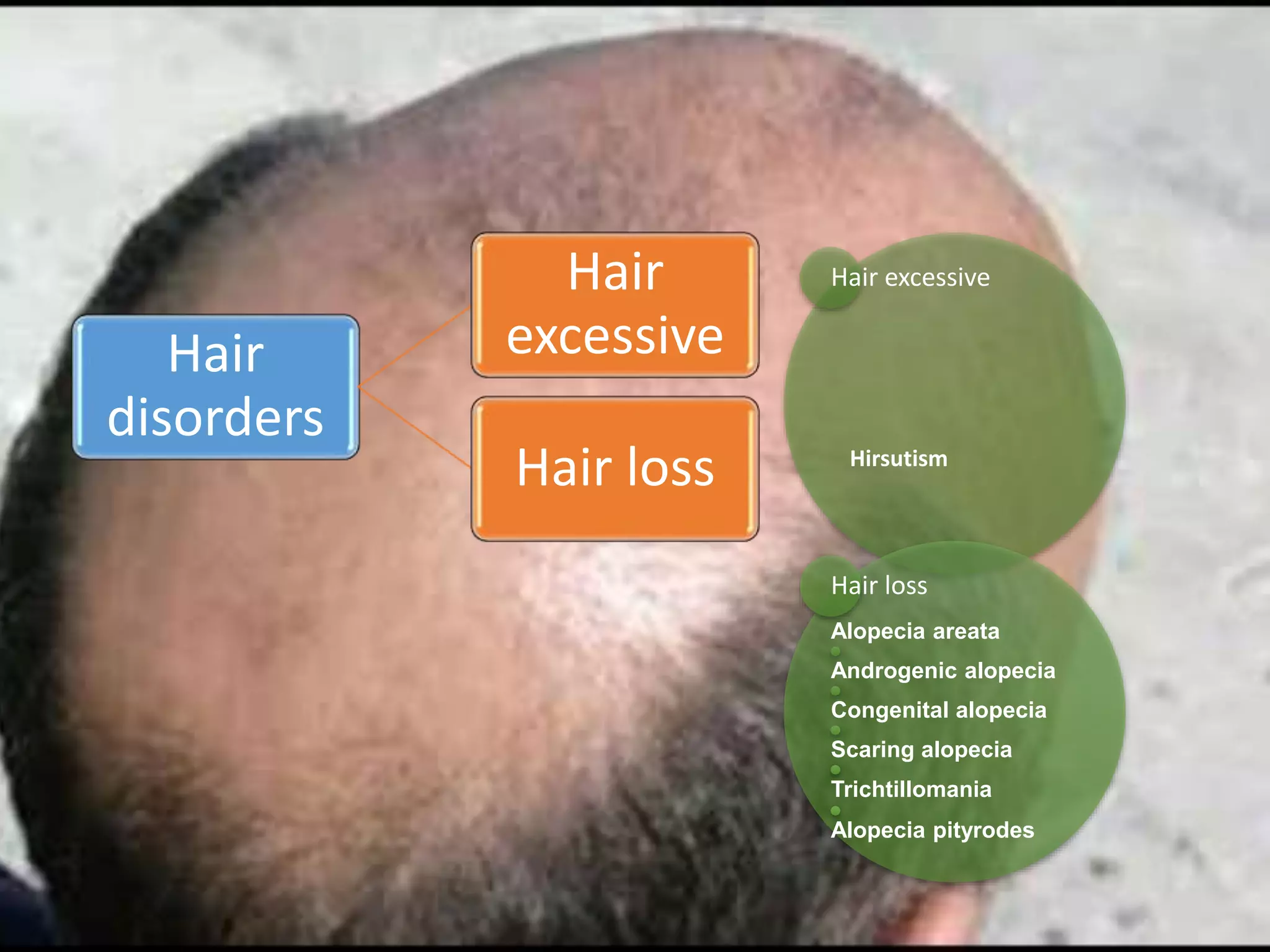 hair diseases | PPTX