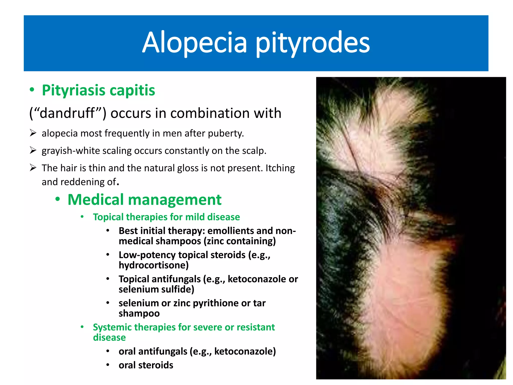 hair diseases | PPTX