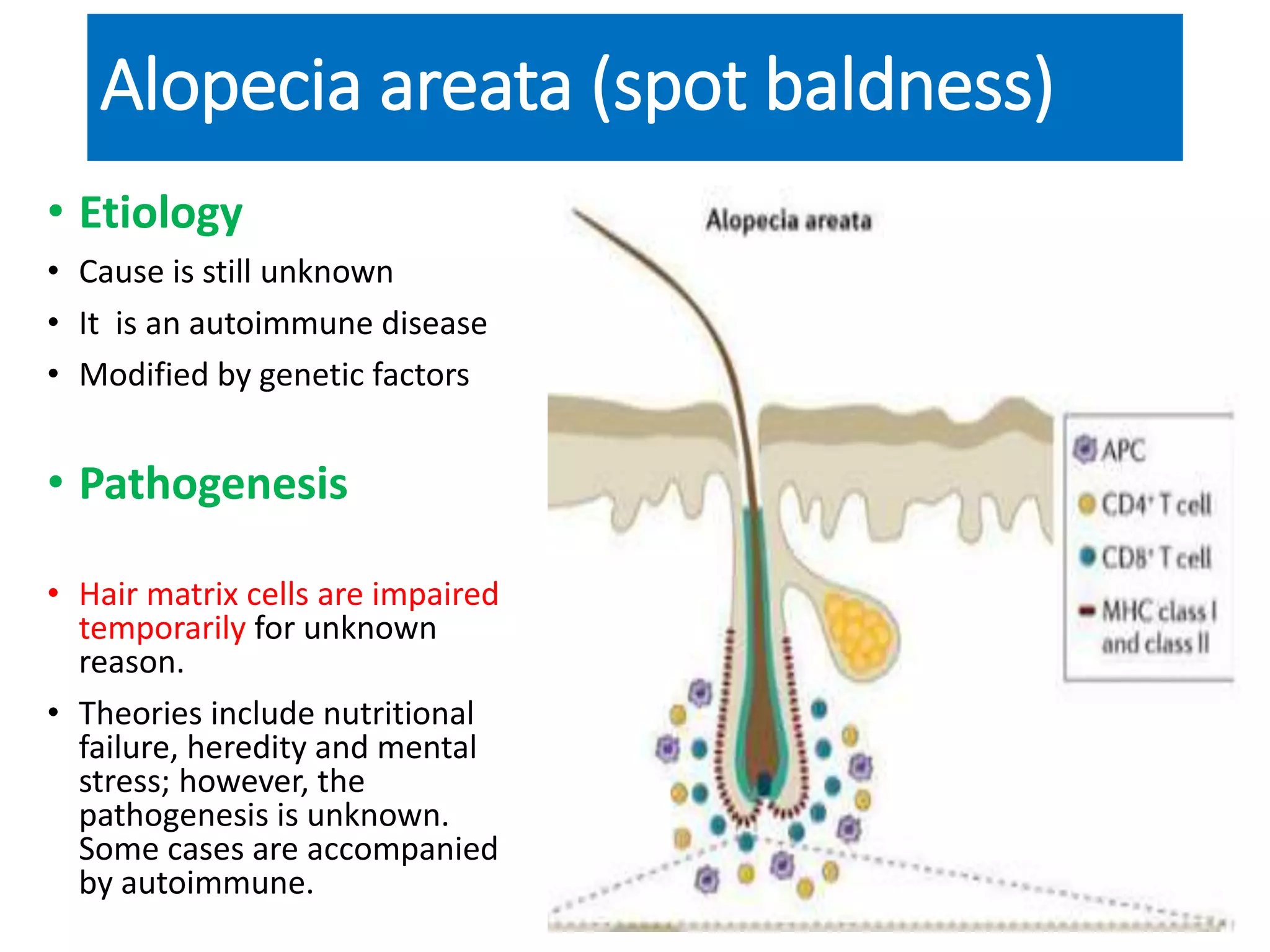 hair diseases | PPTX