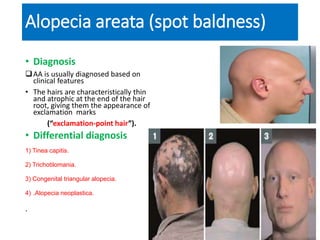 hair diseases | PPTX