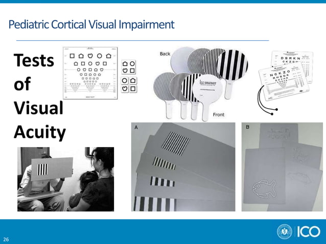 AAO: Pediatric Cortical Visual Impairment | PPTX