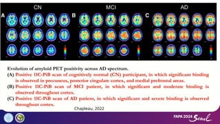 Alzheimer's Disease Biomarkers in clinical trials | PPTX