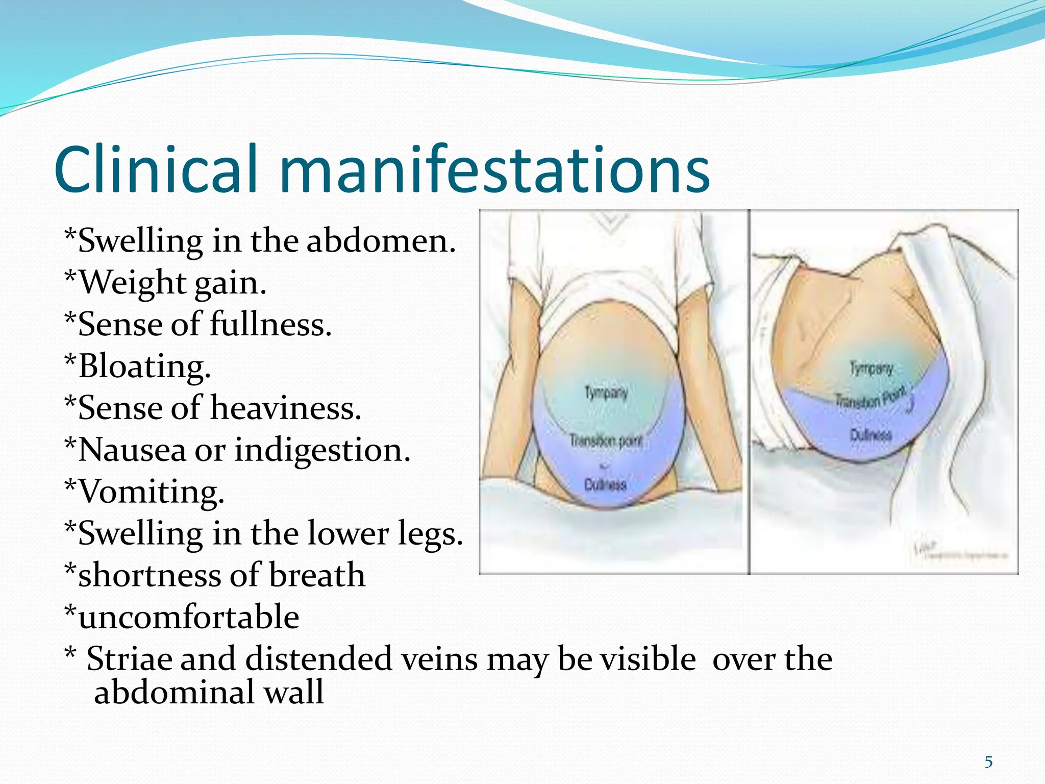 Ascites definition, causes, clinical manifestations,diagnosis .pptx ...