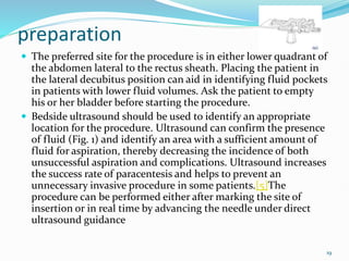 Ascites definition, causes, clinical manifestations,diagnosis .pptx