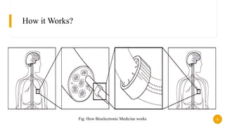 Bioelectronic Medicines | Personalized Medicine | Drug Delivery System ...