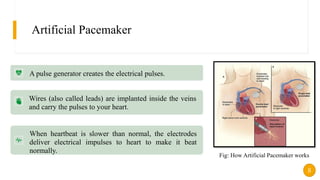 Bioelectronic Medicines | Personalized Medicine | Drug Delivery System ...