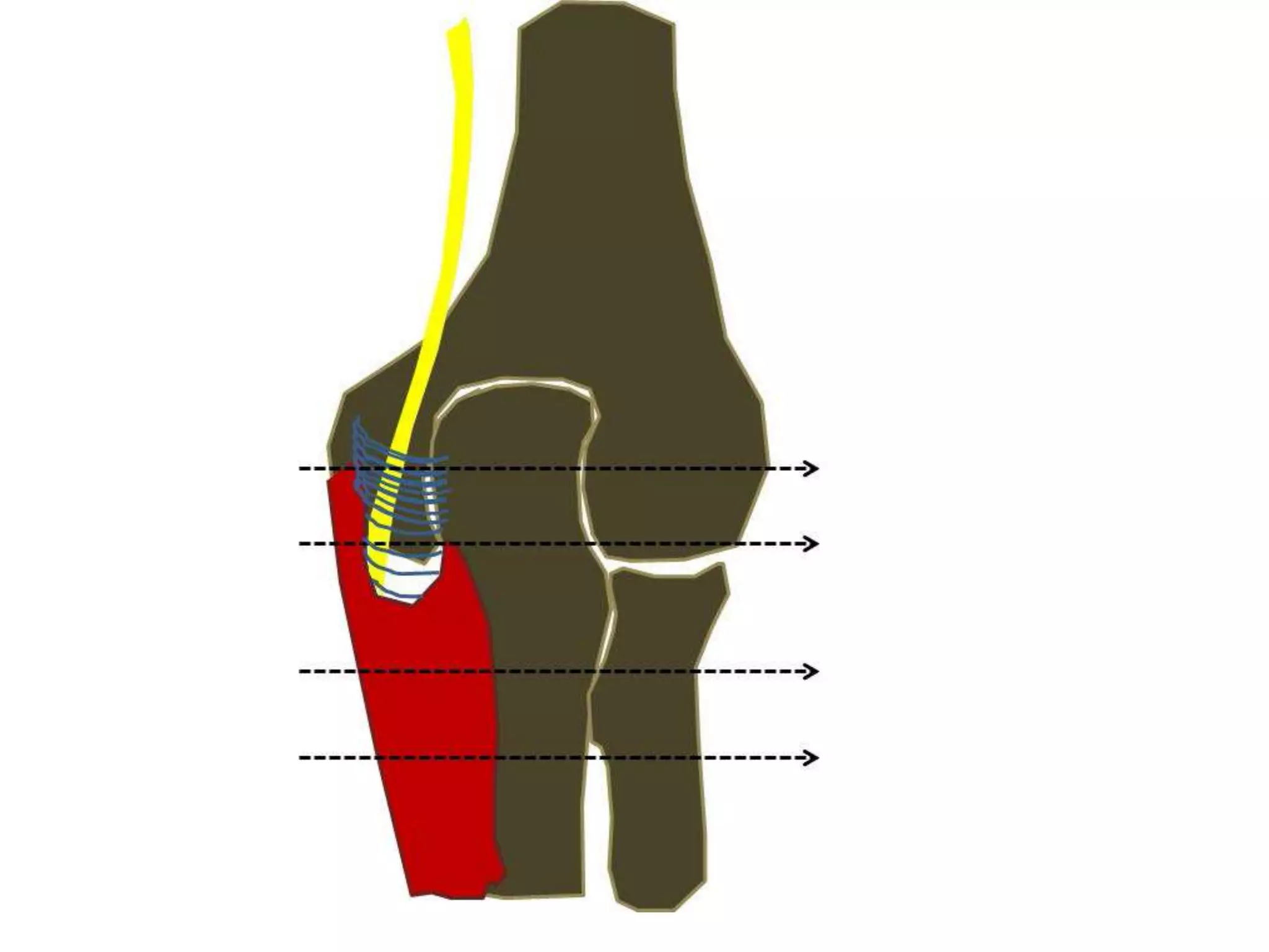Updated Elbow Musculoskeletal US Examination | PPTX