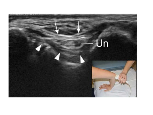 Updated Elbow Musculoskeletal US Examination | PPTX