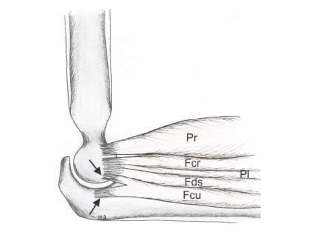 Updated Elbow Musculoskeletal US Examination | PPT