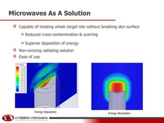 Emblation Microwave | PPTX | Medical Health