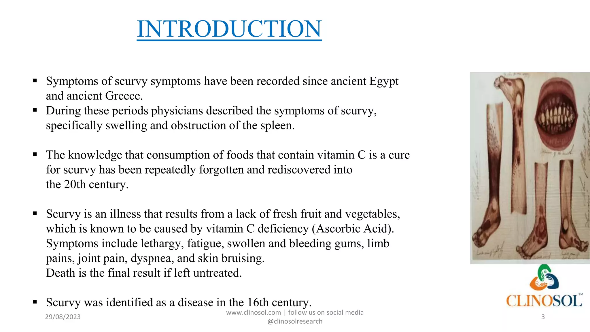 Construction of Clinical Trials - The James Lind Era | PPTX
