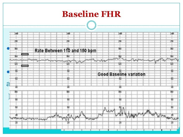 Updated intrapartum monitoring
