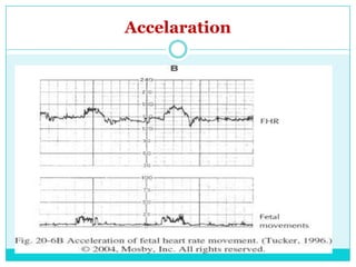 Accelerations Fhr