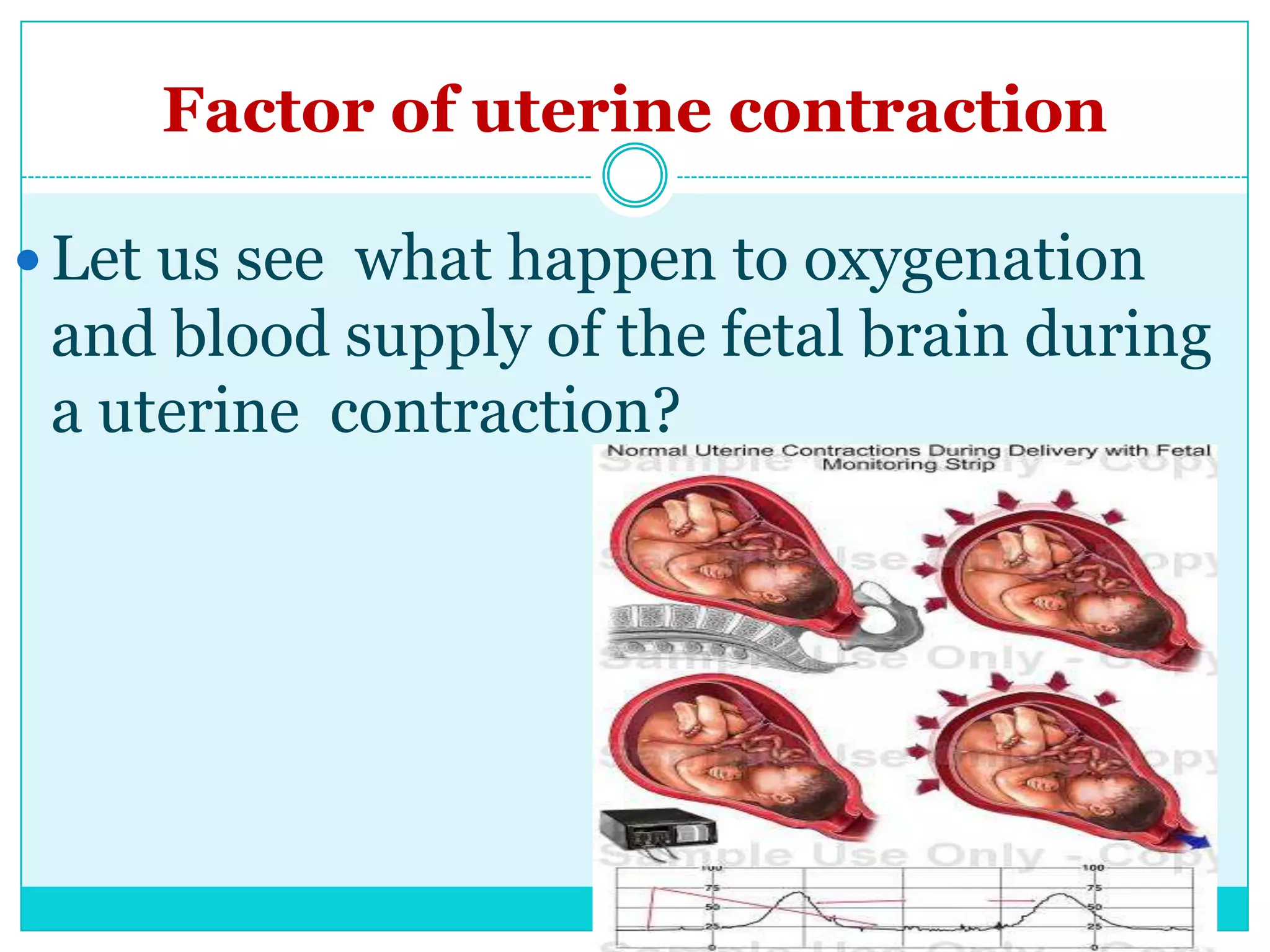 Updated intrapartum fetal monitoring | PPT