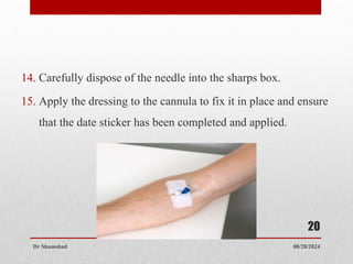 Procedure of IV cannulation for reference | PPT