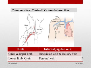 practical on procedure Intravenous cannulation. | PPT