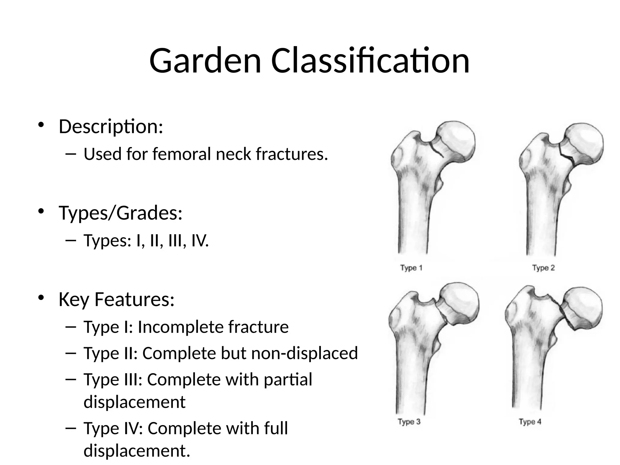 Updated_Orthopedic_Trauma_Classifications.pptx