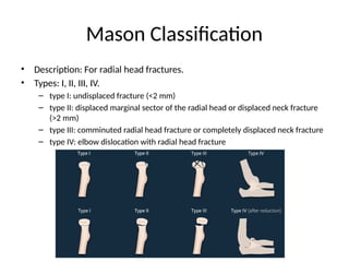 Updated_Orthopedic_Trauma_Classifications.pptx