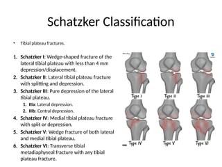 Updated_Orthopedic_Trauma_Classifications.pptx