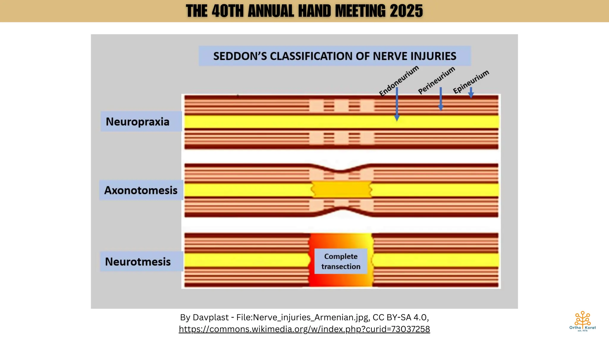 Updated in Protocol: Radial Nerve Problems in Humeral Fracture | PDF