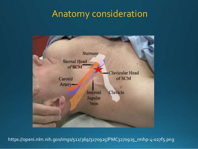 Updated vascular topic cvc