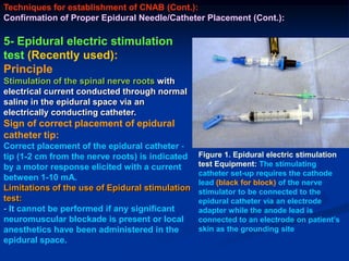 Update in Central Neuraxial Blockade in Pediatrics | PDF