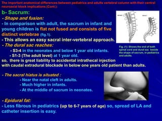 Update in Central Neuraxial Blockade in Pediatrics | PPT