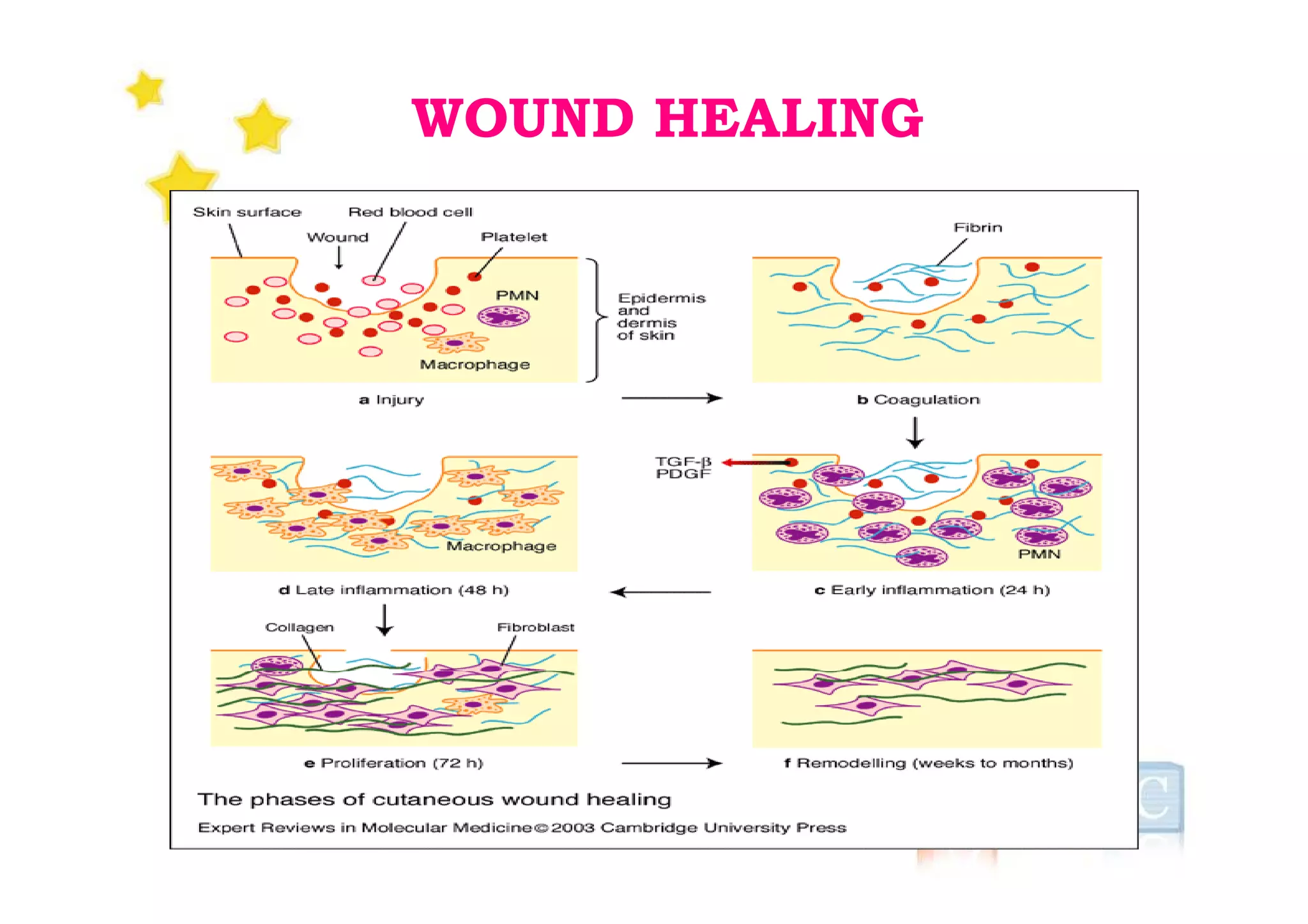 Update management in wound care 16 oct 13 | PDF