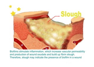 Update management in wound care 16 oct 13 | PPT