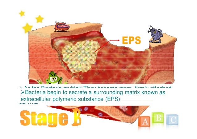 biofilm on wound bed
