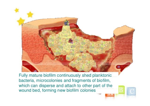 Update management in wound care 16 oct 13