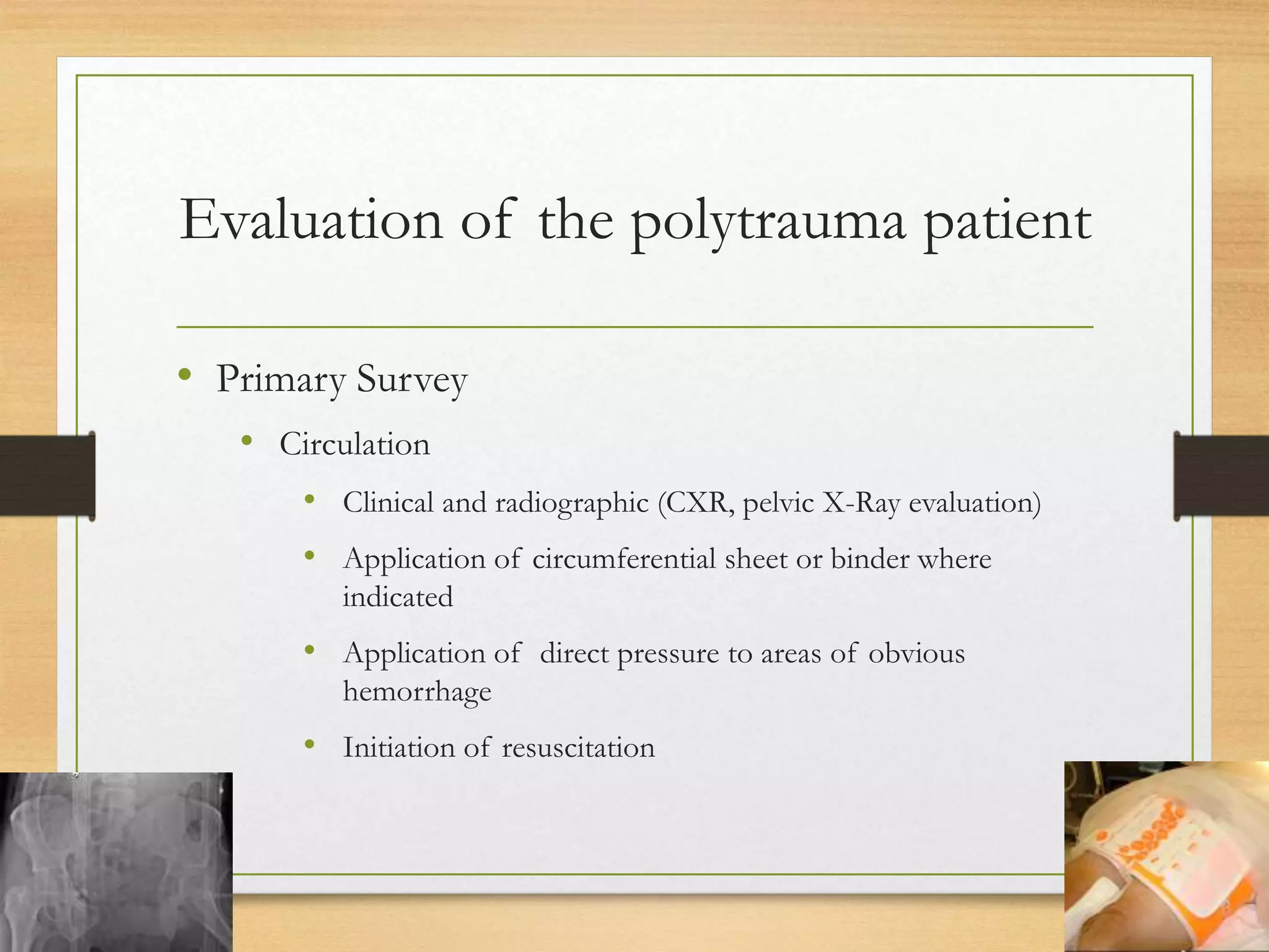 Update of management polytrauma patient | PPTX