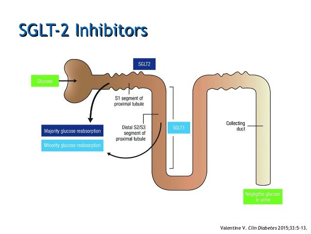 Update on diabetes treatment strategies 2017