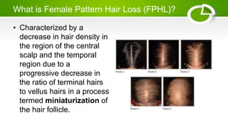 Update on female pattern hair loss2 | PPTX