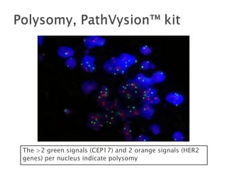 Update on HER2 testing | PPTX