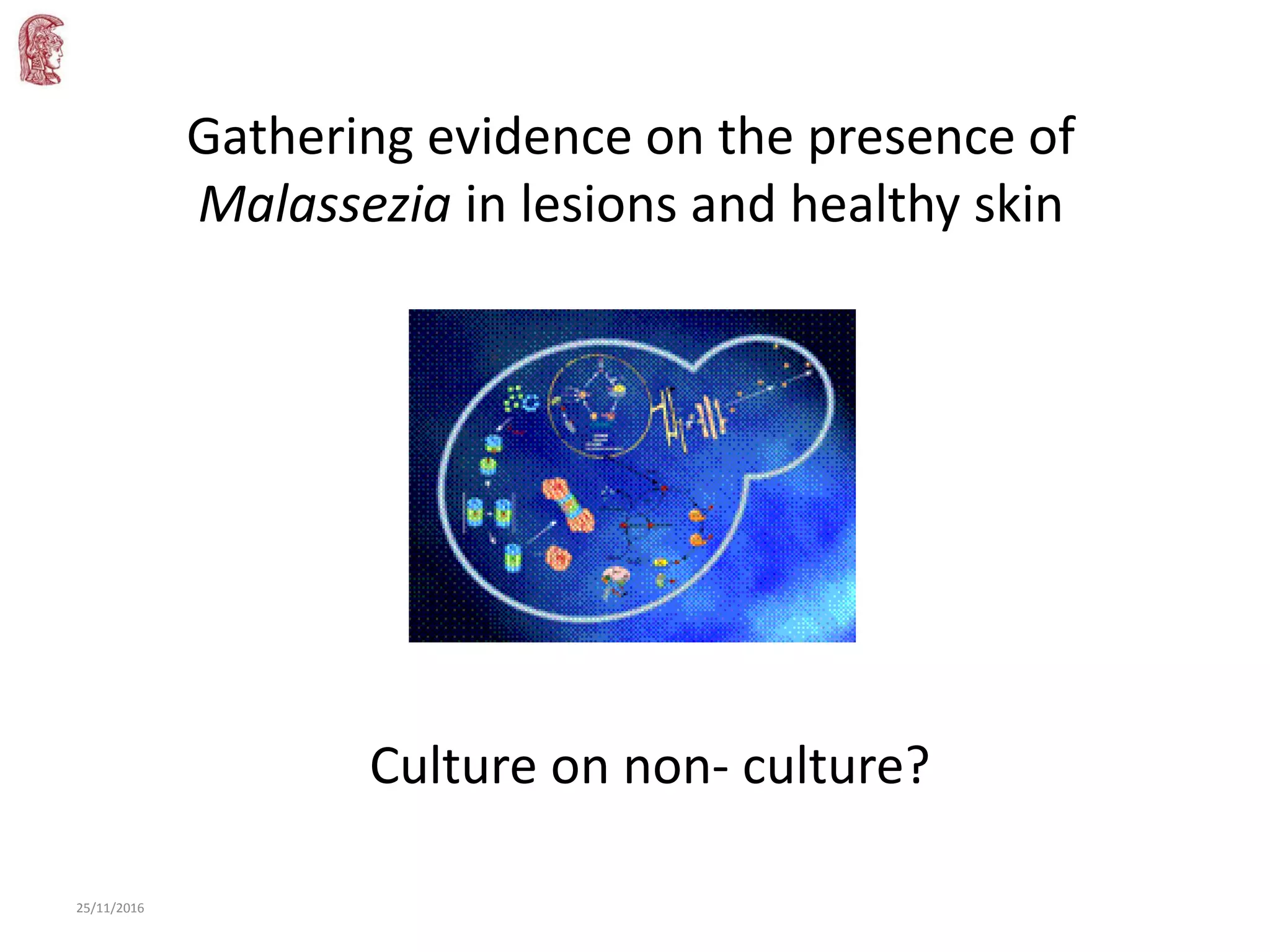 Update on malassezia associated skin diseases1 | PDF