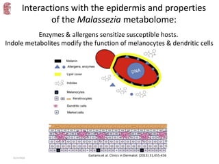 Update on malassezia associated skin diseases1 | PDF