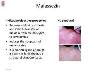 Update on malassezia associated skin diseases1 | PDF