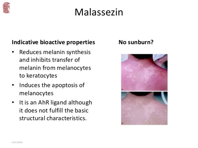 Update on malassezia associated skin diseases1