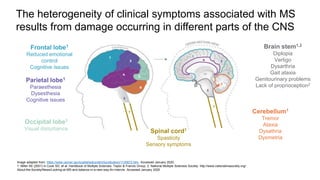 Understanding Multiple Sclerosis and Management Updates | PPTX