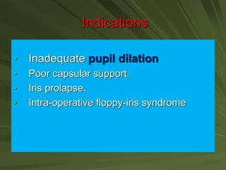Update on pupil stretching and capsular stabilization devices | PPT