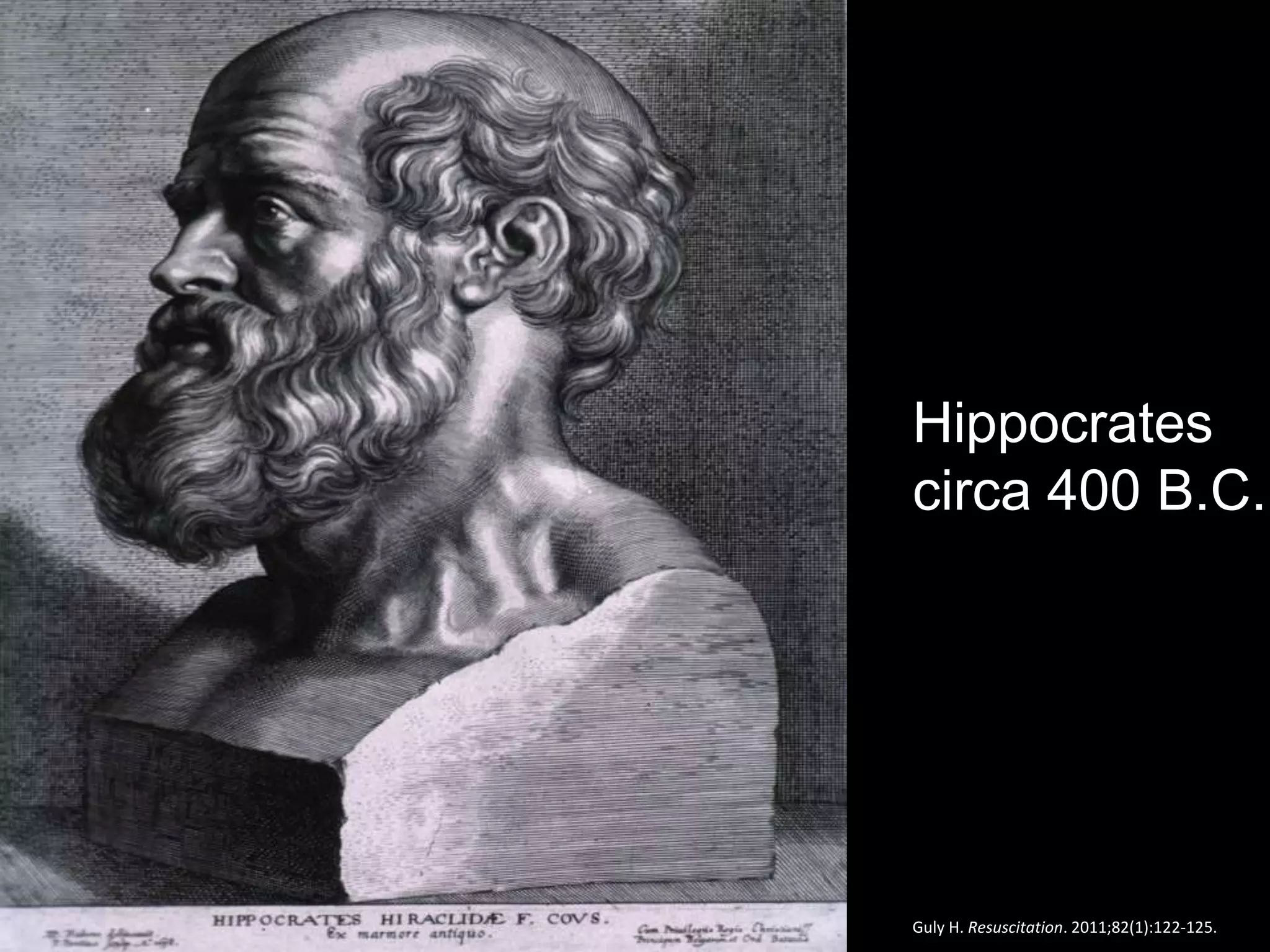 Update on Targeted Temperature Management | PPT