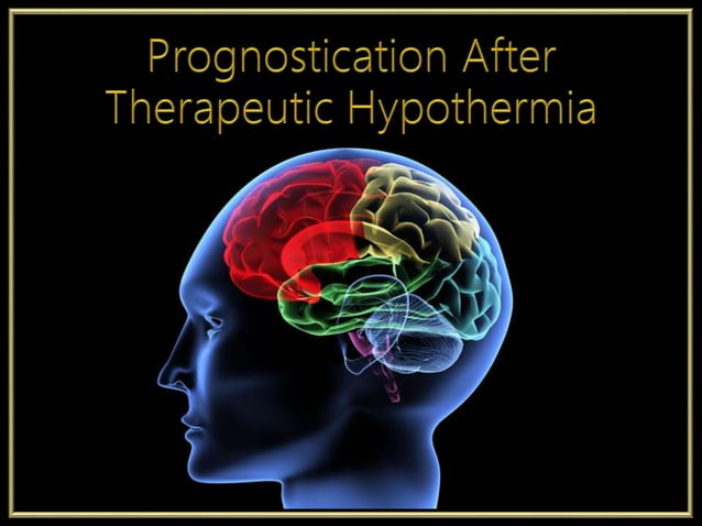 Update on Targeted Temperature Management | PPT
